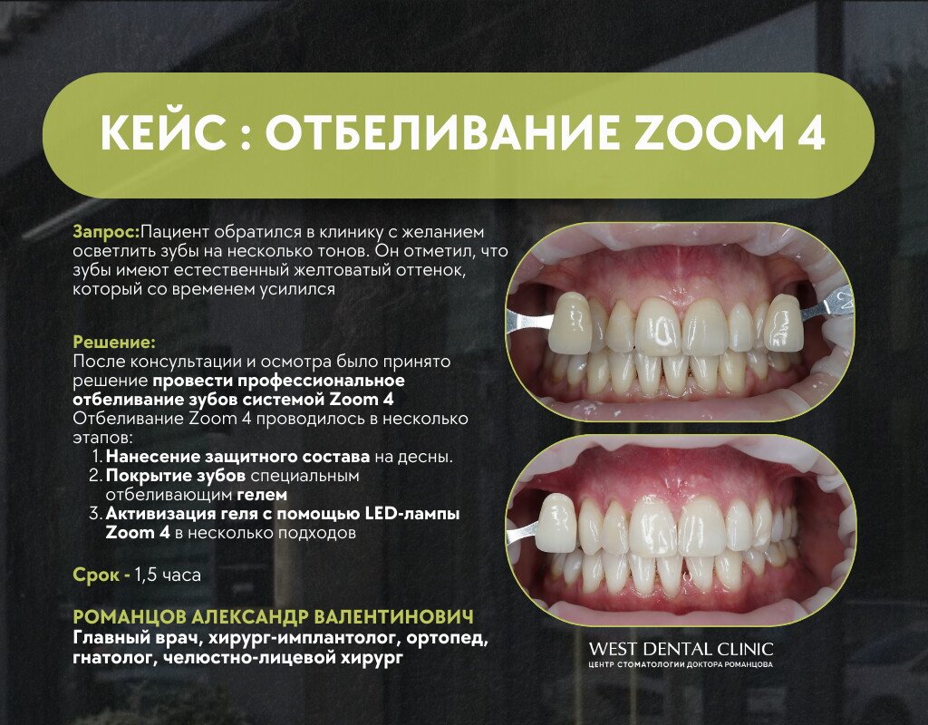 Центр стоматологии доктора Романцова «West Dental Clinic» на метро ...
